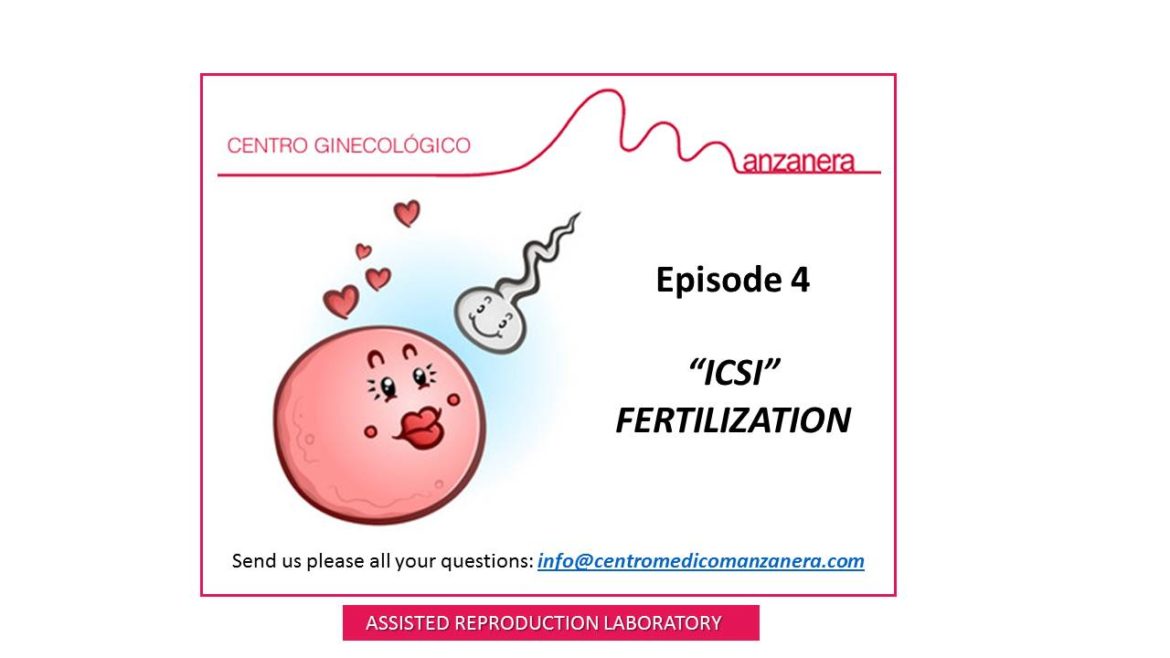 EPISODE 4. ICSI FERTILIZATION WITHIN FERTILITY TREATMENTS (IVF ... EPISODE 4. ICSI FERTILIZATION WITHIN FERTILITY TREATMENTS (IVF ...