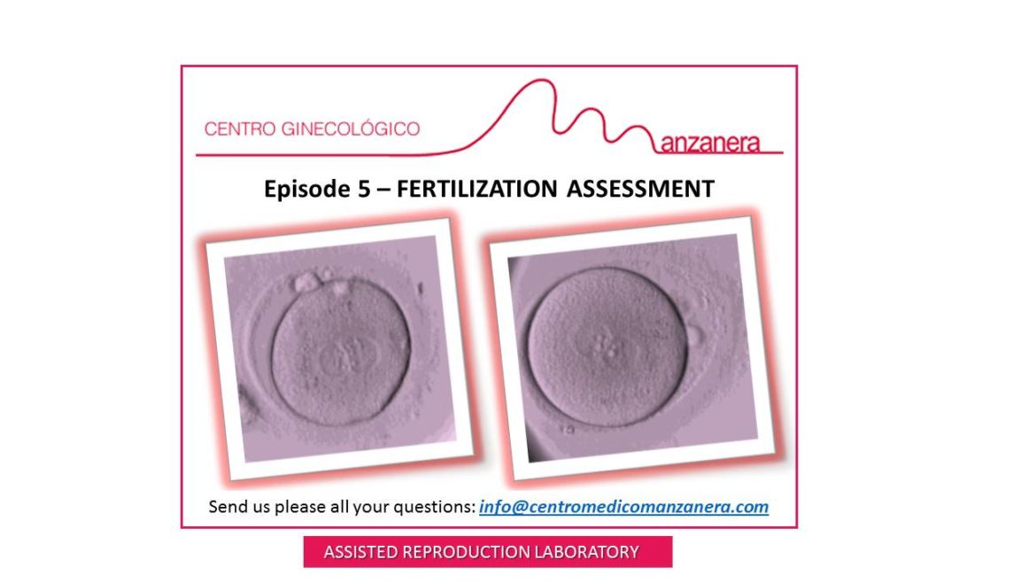 EPISODE 5. FERTILIZATION ASSESSMENT WITHIN ASSISTED REPRODUCTION ...