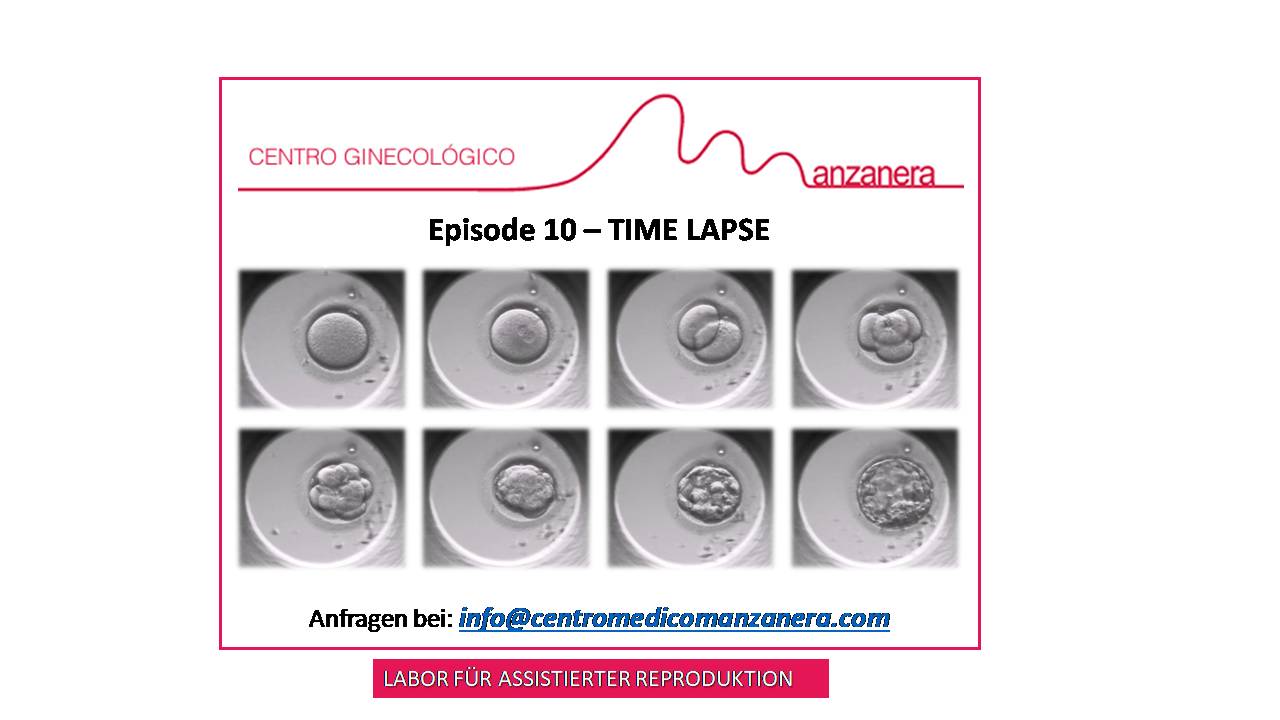 EPISODE 10. TIME-LAPSE BEI BEHANDLUNGEN DER ASSISTIERTEN REPRODUKTION ...